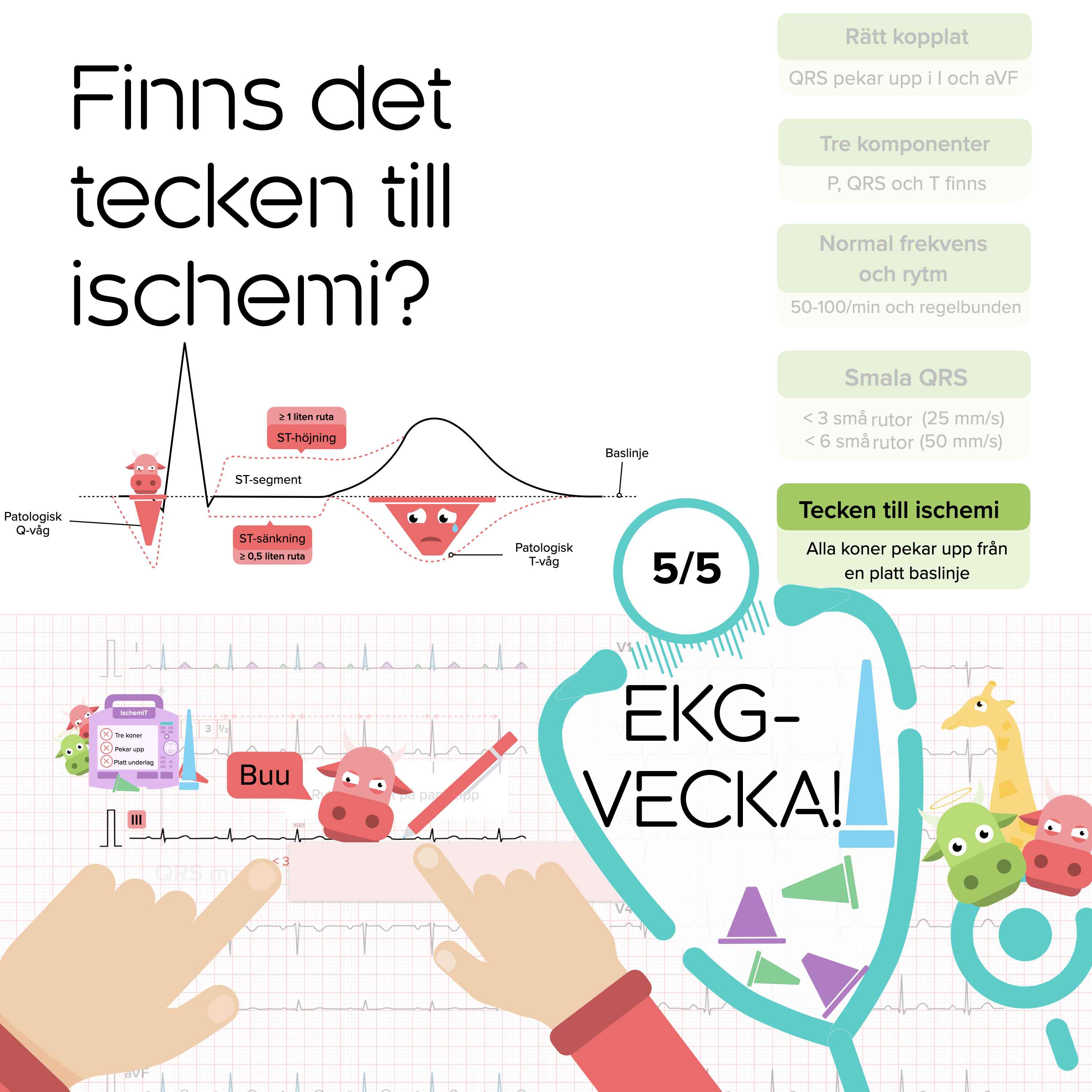Finns det tecken till ischemi? - podcast - MedEasy
